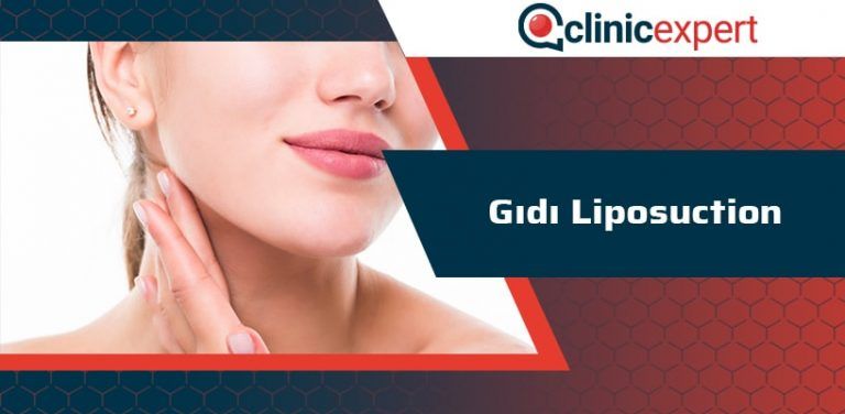 Gıdı Liposuction | Clinic Expert
